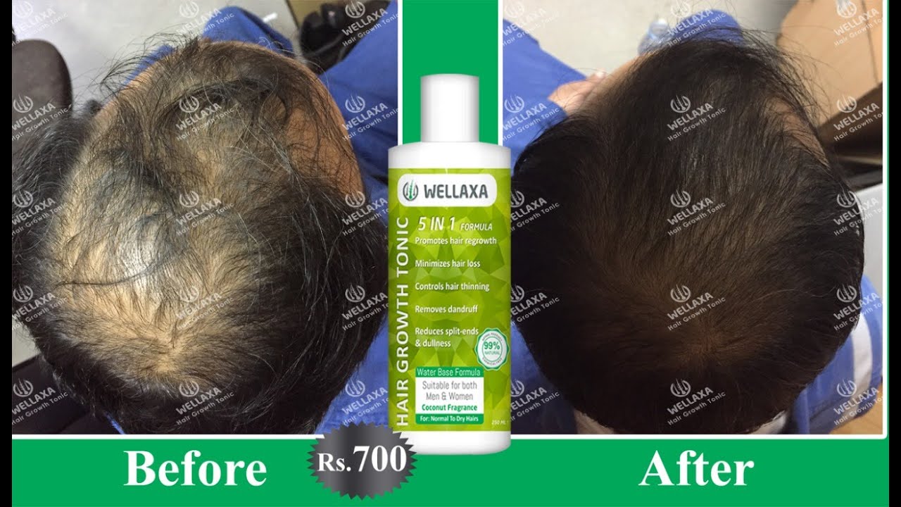 Wellaxa Products VIdeos - YouTube