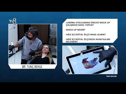 Lamine Uygulaması Öncesi Mock  Up Çalışması Nasıl Yapılır? | Diş Hekimi Tunç Berge