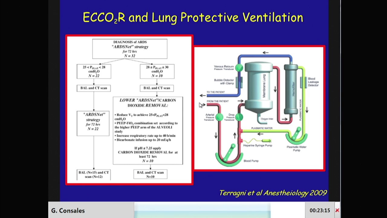 G. Consales - Tailoring ECCO2-R therapy: is ARDS different from COPD ...