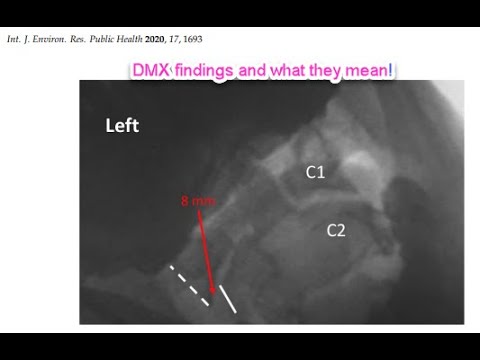 DMX Findings and what they mean! - YouTube