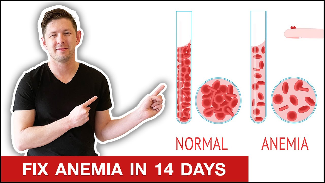How To QUICKLY Fix Anemia & Low Red Blood Cell Count with Colitis - YouTube