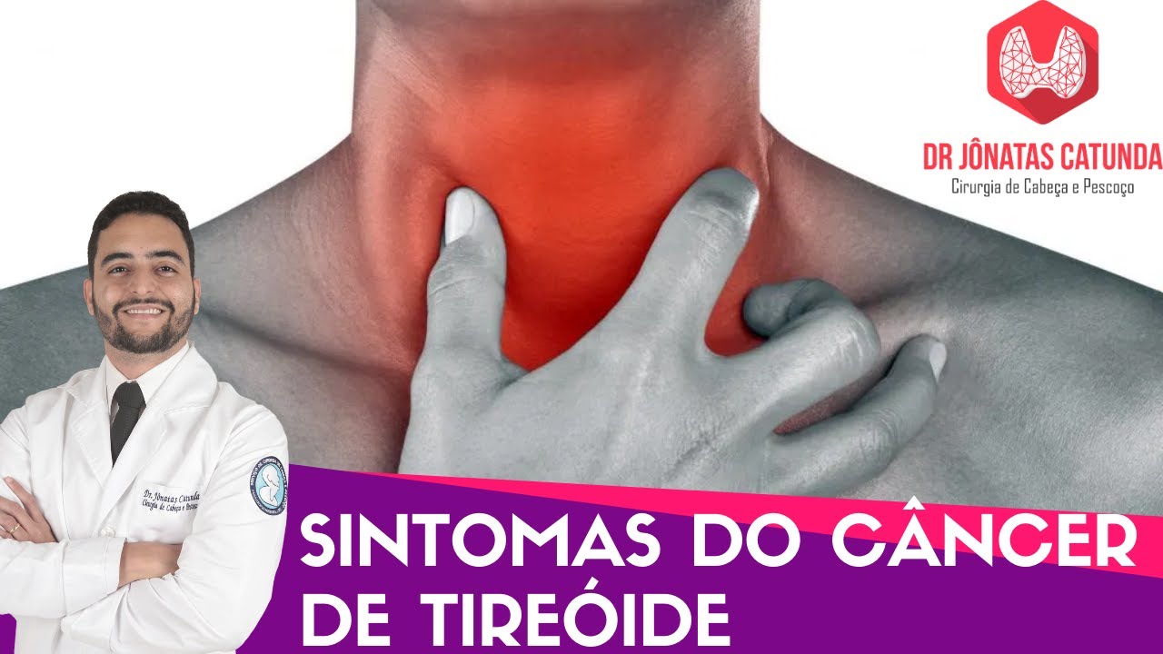 Sintomas do câncer de tireoide - Caroço no pescoço? Rouquidão? Dor na ...