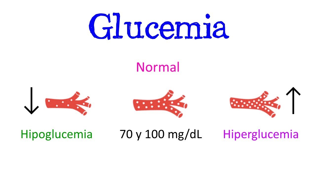 💥 Glucemia, Hipoglucemia e Hiperglucemia 💥 ¿Qué son? Características y ...