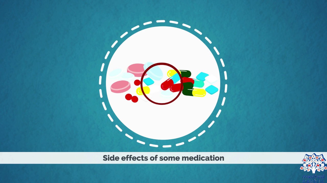 Snoring, Causes, Signs and Symptoms, Diagnosis and Treatment. - YouTube