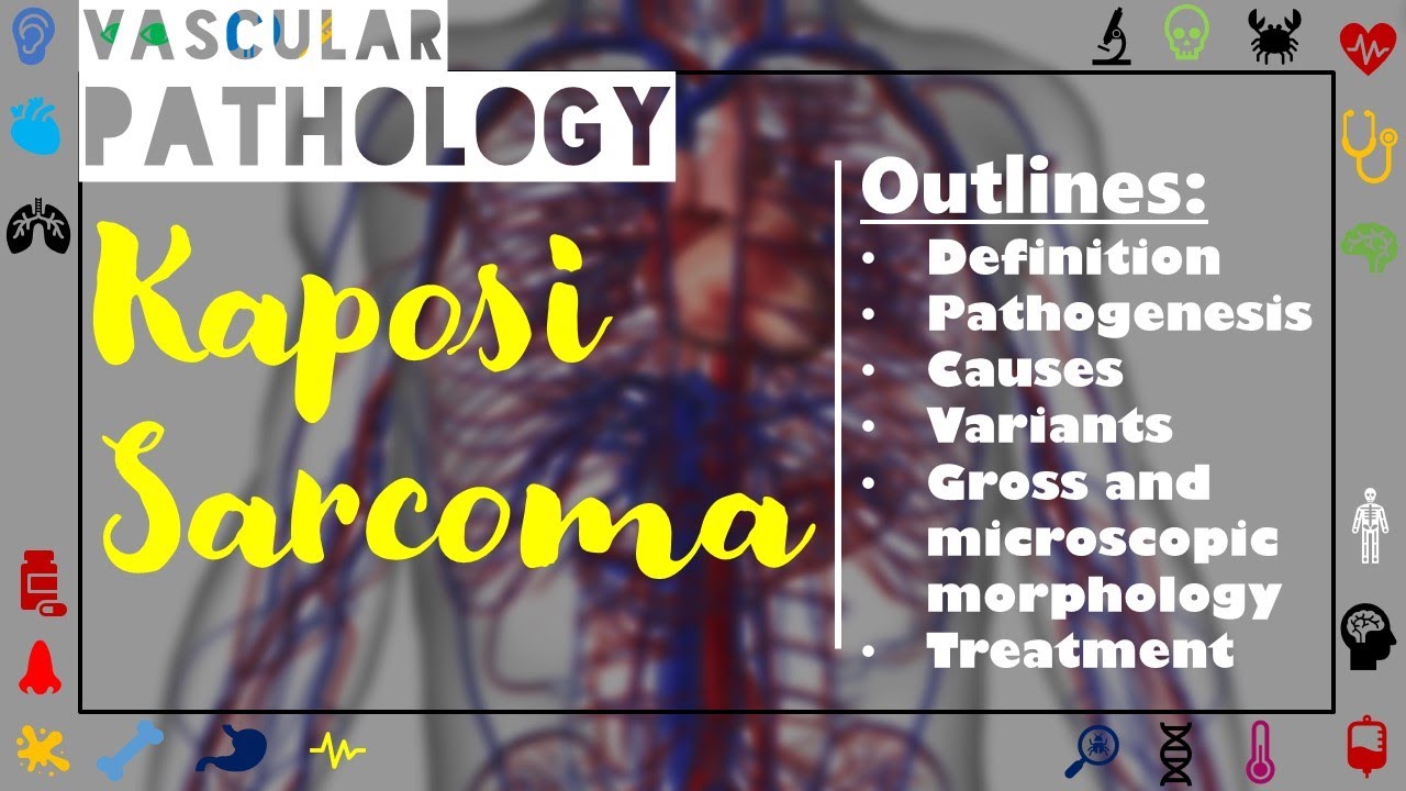 Kaposi S Sarcoma Guide Causes Symptoms And Treatment Options Hot Sex Picture