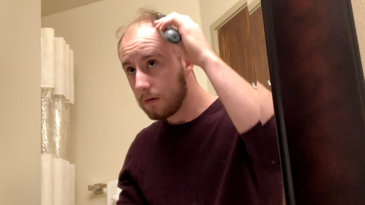 BALDING YOUNG - GOING BALD Shaving My Head From Now On - LIVE 13 - YouTube