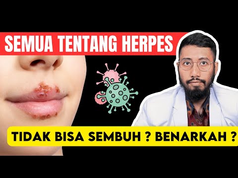 Semua tentang Herpes: TIDAK BISA SEMBUH ?!