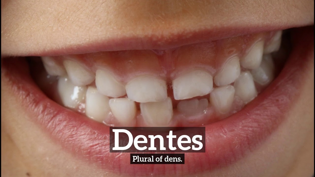 How Do Dentes Look? | How to Say Dentes in English? | What are Dentes ...
