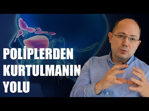 Burundaki Poliplerden Nasıl Kurtuluruz - Polip Ameliyatı Nasıl Yapılır - Burun Etiyle Karıştırılıyor