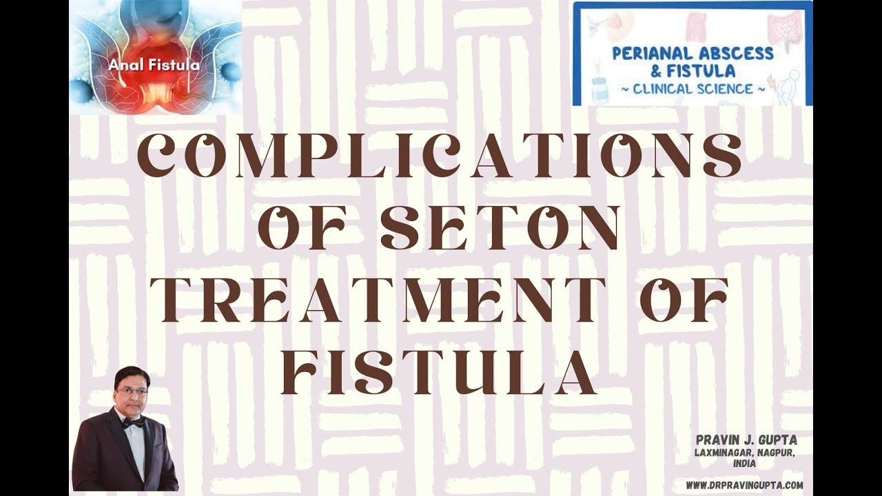 COMPLICATIONS OF SETON TREATMENT OF ANAL FISTULA - YouTube