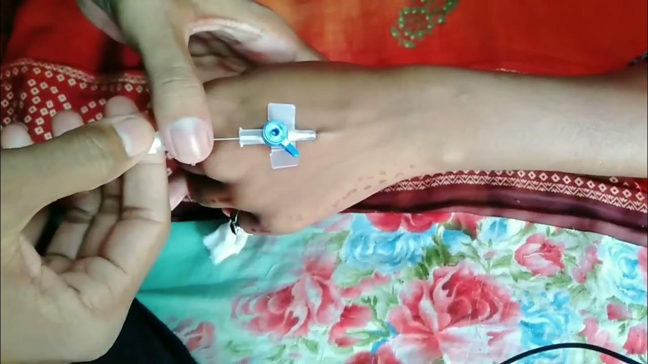 Intravenous Cannulation Technique || Iv Cannula Procedure || Cannula - YouTube