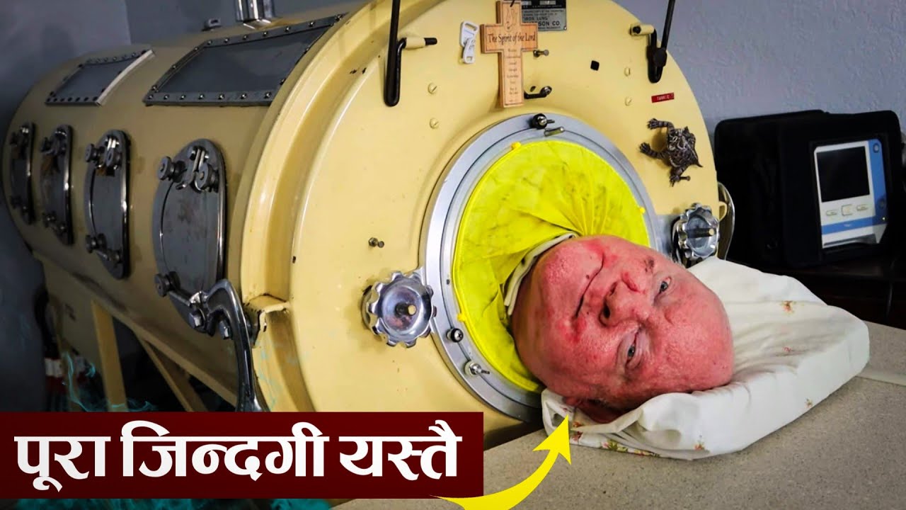 Sad Story Of Paul Alexander- The Man In The IRON LUNG || Fact Nepal ...