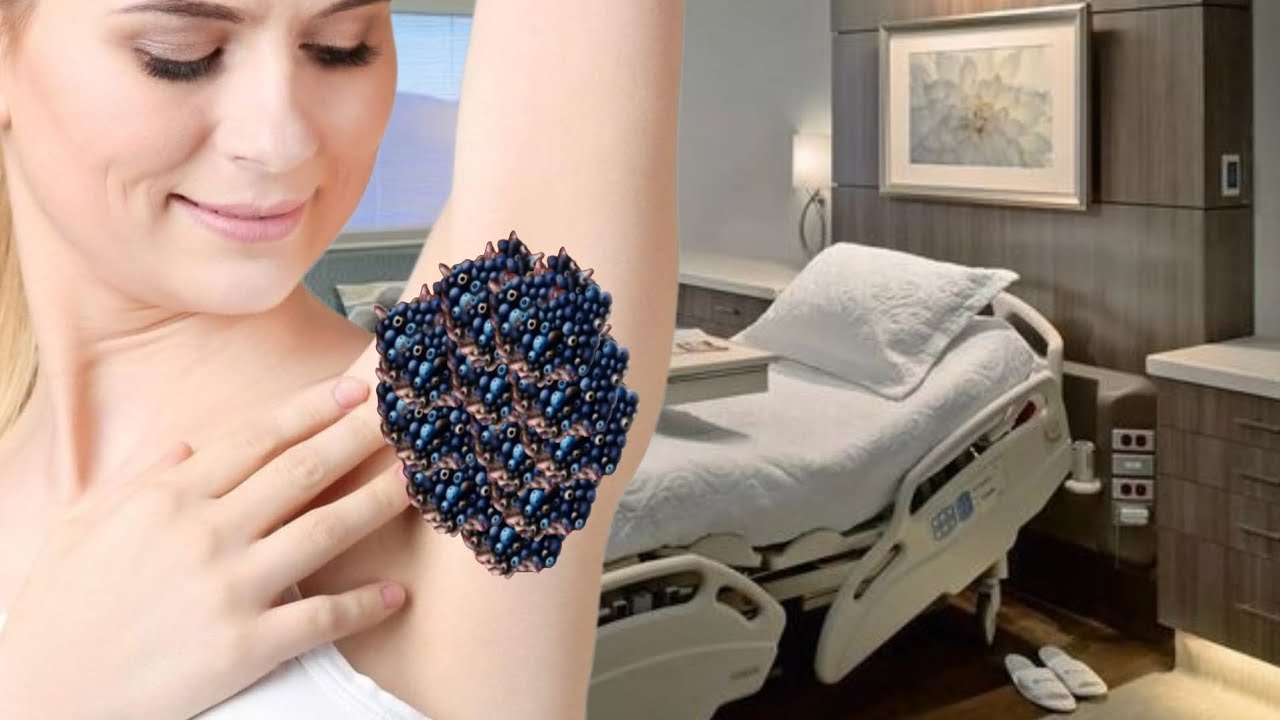 Girl Armpit treatment ASMR Removal Dog Ticks & Maggot Infected Armpit ...