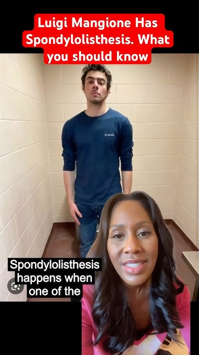 LUIGI MANGIONE Has Spondylolisthesis. What is this? #shorts #shortsvideo #shorsfeed - YouTube