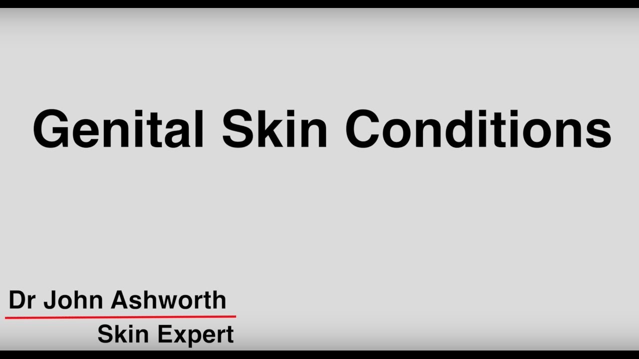 Genital skin conditions - YouTube