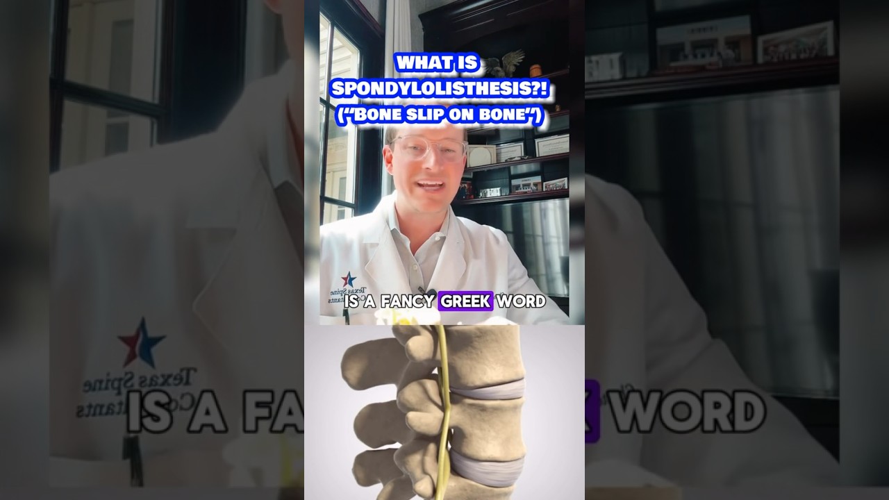 Explaining “spondy” and spondylolisthesis in the spine- and what to do ...