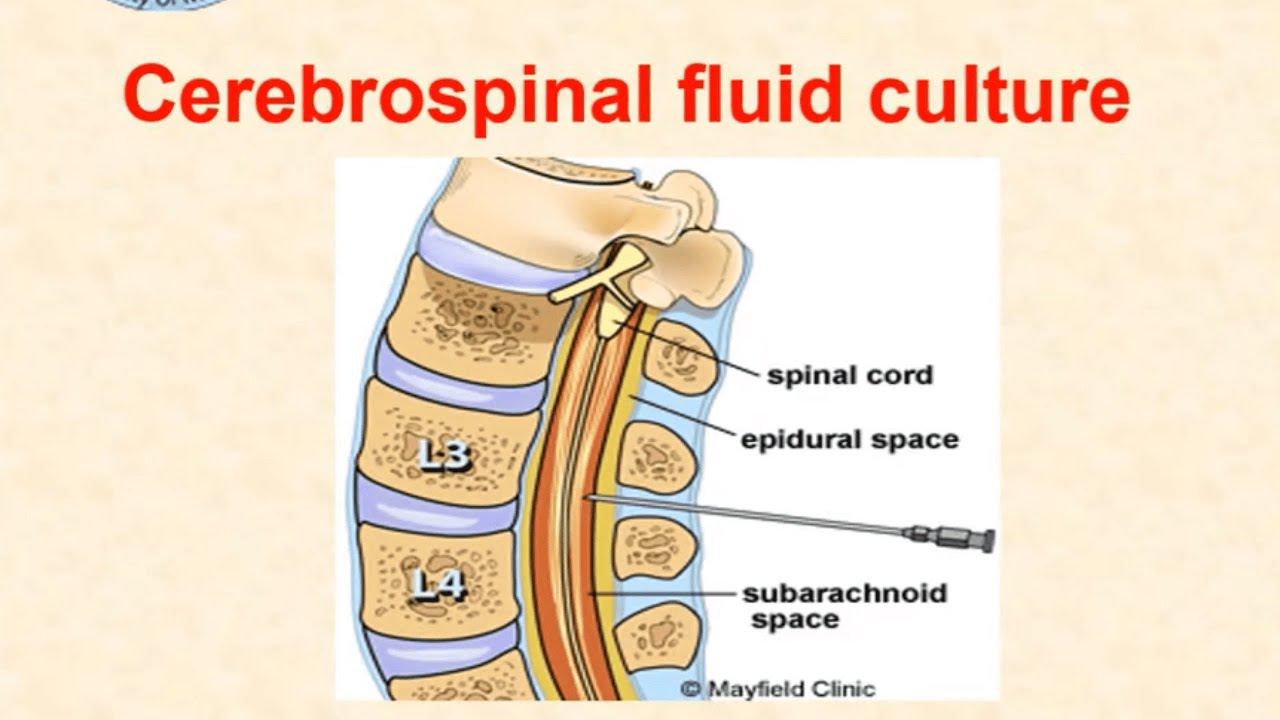 Cerebrospinal fluid culture | Micro Lab 2 - Dr. Ismail - YouTube
