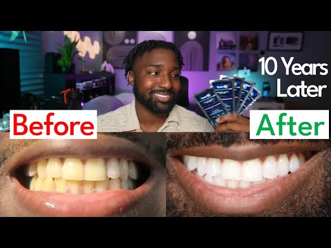 Crest 3D Whitestrips: 10 Years Later Review + Oral Care Tips