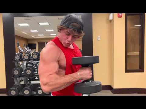 Jamie update March 28th, 2022