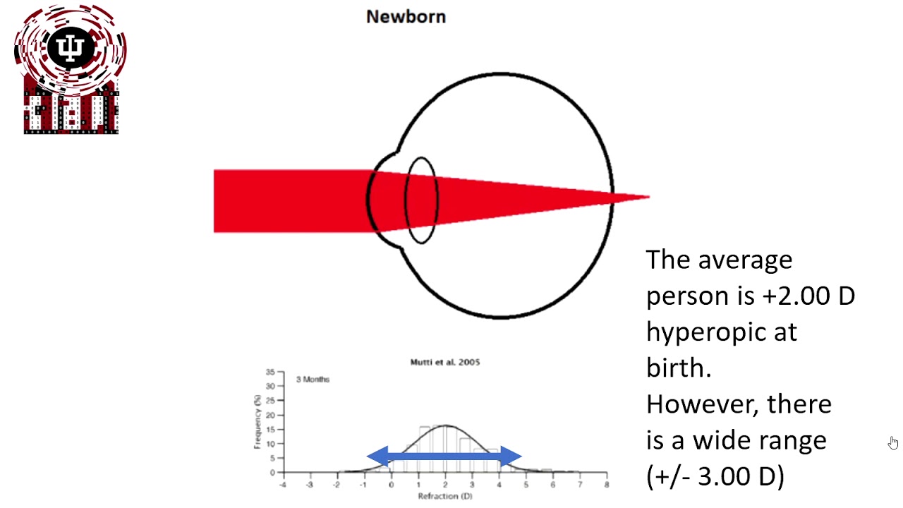 Emmetropization Basics Source - YouTube