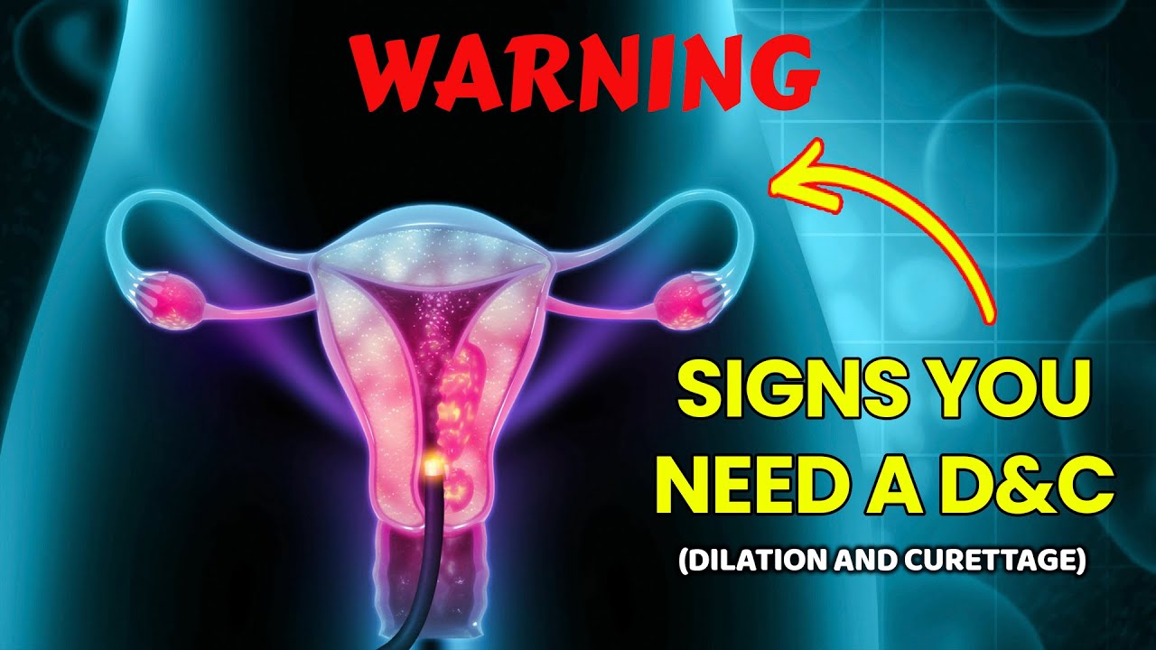 🌸 WARNING: Signs You Might Need a D&C | Unveiling Women's Health ...