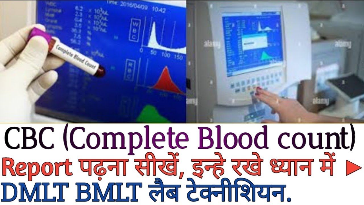 CBC(Complete blood count) how to read cbc report in hindi. cbc टेस्ट ...