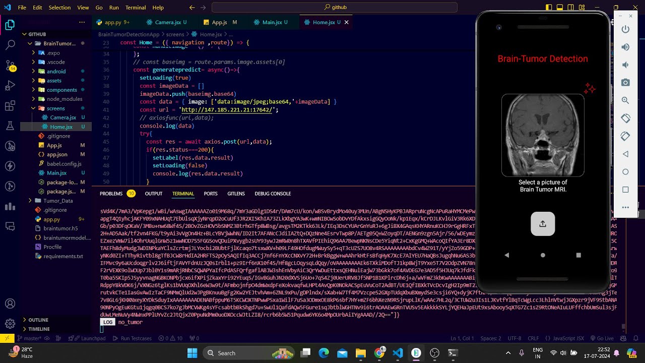 BrainTumor Detection App - YouTube