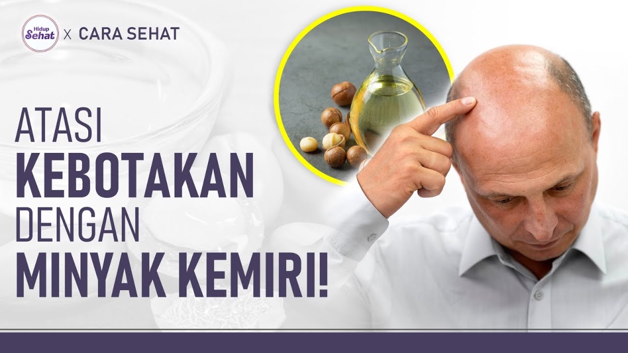 Cara Buat Minyak Kemiri untuk Rambut Rontok Hingga Botak | Hidup Sehat ...
