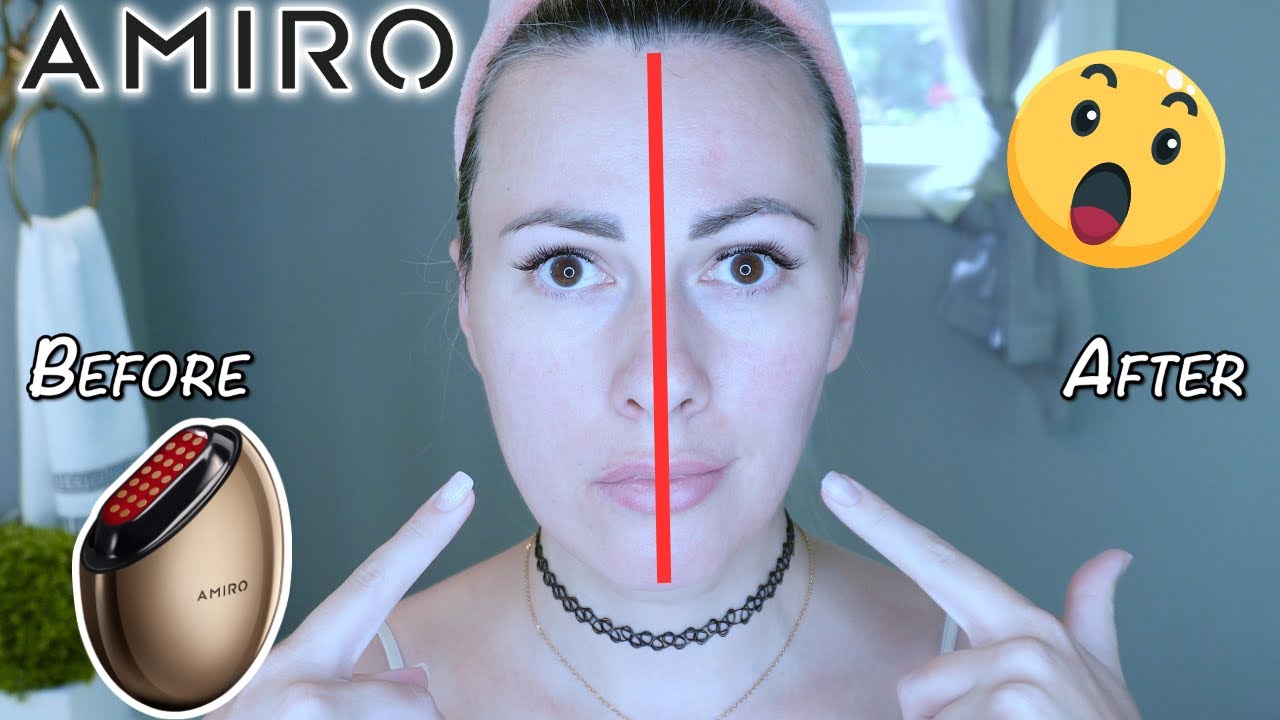AMIRO S1 Facial RF Skin Tightening Device Review + AMIRO Dedicated Facial Mask + Preparation Gel ...