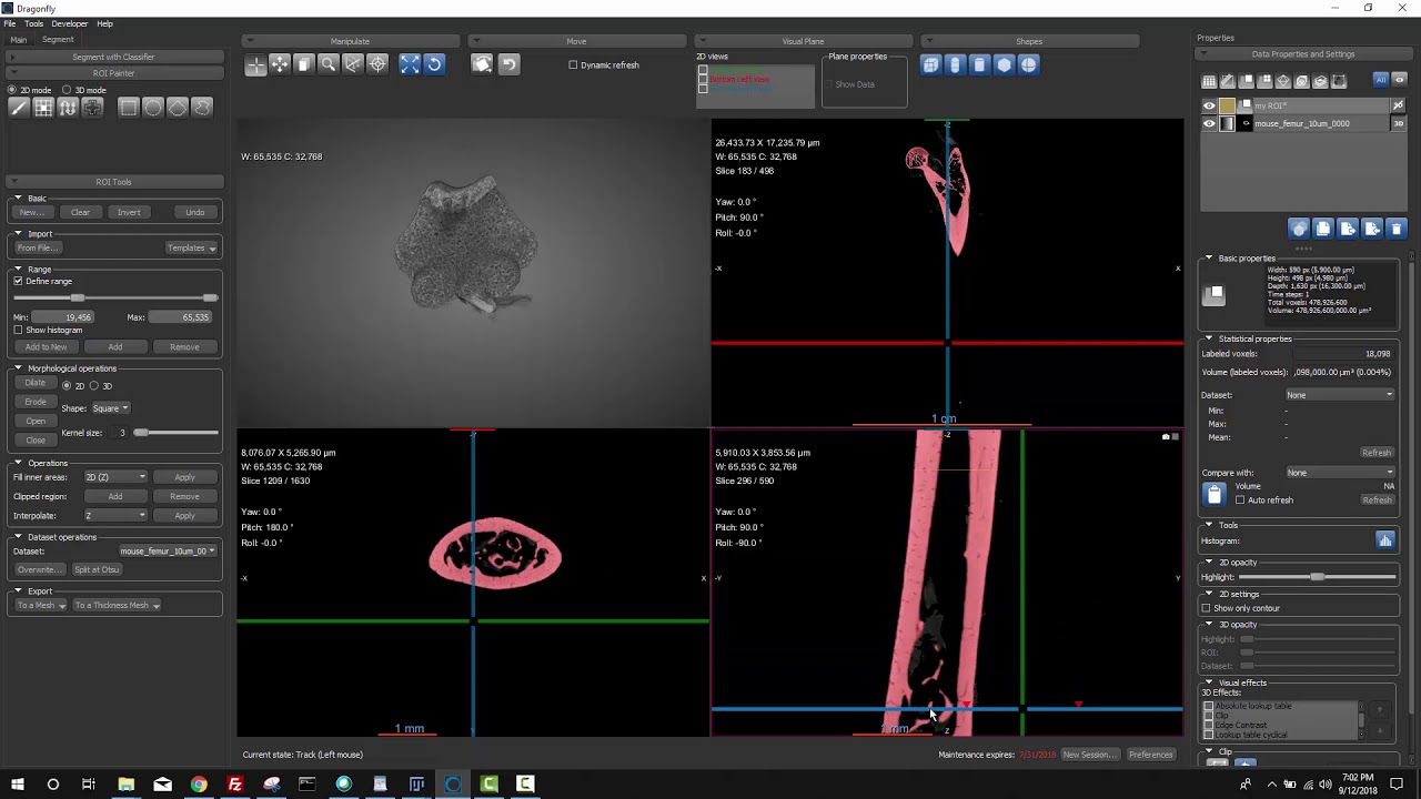 Dragonfly36 Tutorial Roi Interpolate Youtube