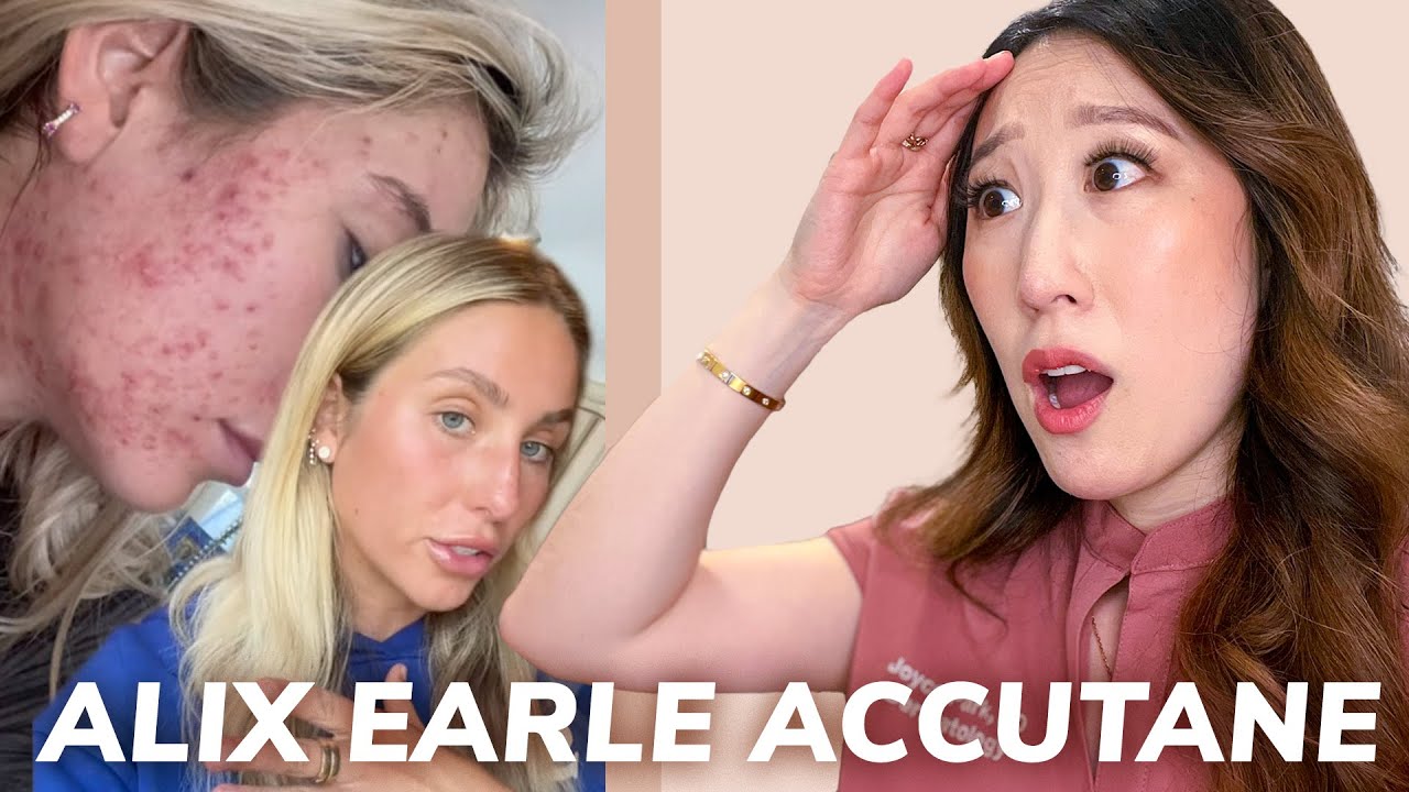 Dermatologist Reacts to Accutane Journey from Alix Earle | Side Effects ...