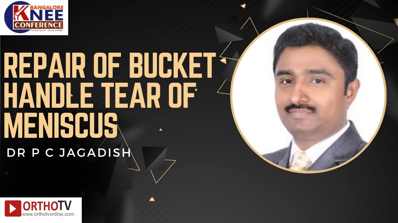 Repair of Bucket Handle Tear of Meniscus - DR P C JAGADISH - YouTube