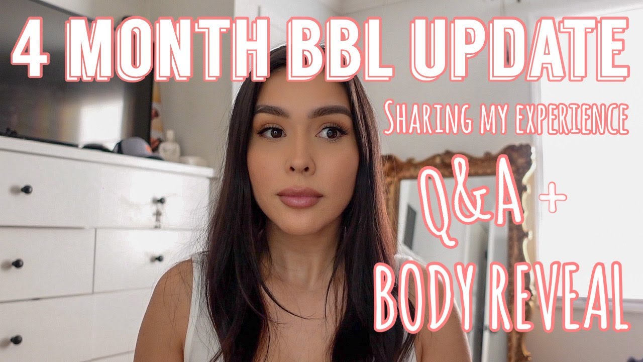 LIPO 360 & BBL UPDATE - 4 MONTHS POST-OP | Sharing my experience, Q&A ...