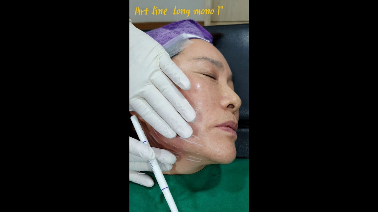 thread mono lifting을이용한동안 얼굴 만들기 - YouTube