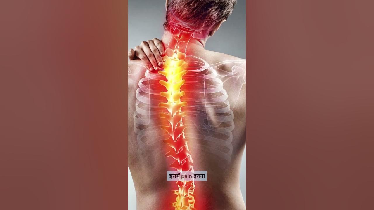 Do you know about Ankylosing Spondylitis? - YouTube