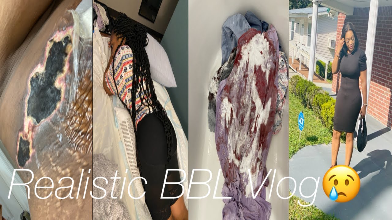 BBL VLOG PT1: RAW & UNCUT FIRST 24 HRS, THE REAL TEA, I HAD A ...