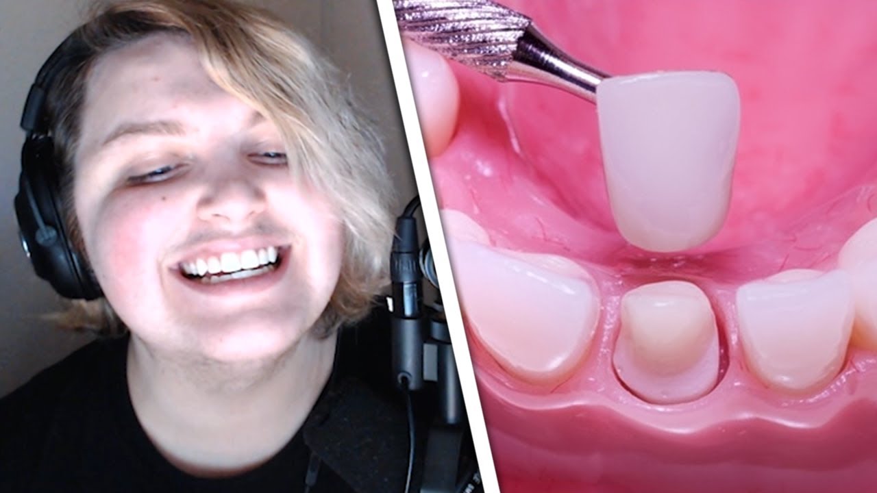 TobyOnTheTele Shows Off Her New Teeth - YouTube