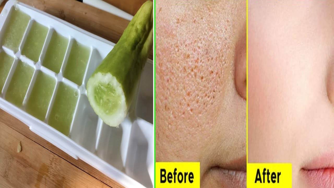 Cucumber Ice Cubes for skin whitening | removes suntan and gives fair, Glowing skin @hsworld9995 ...