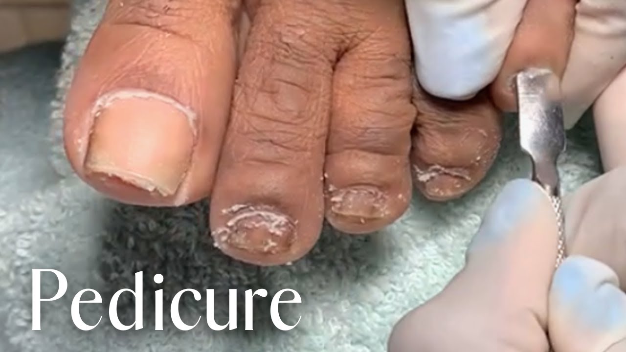 Satisfying Pedicure Transformation - YouTube