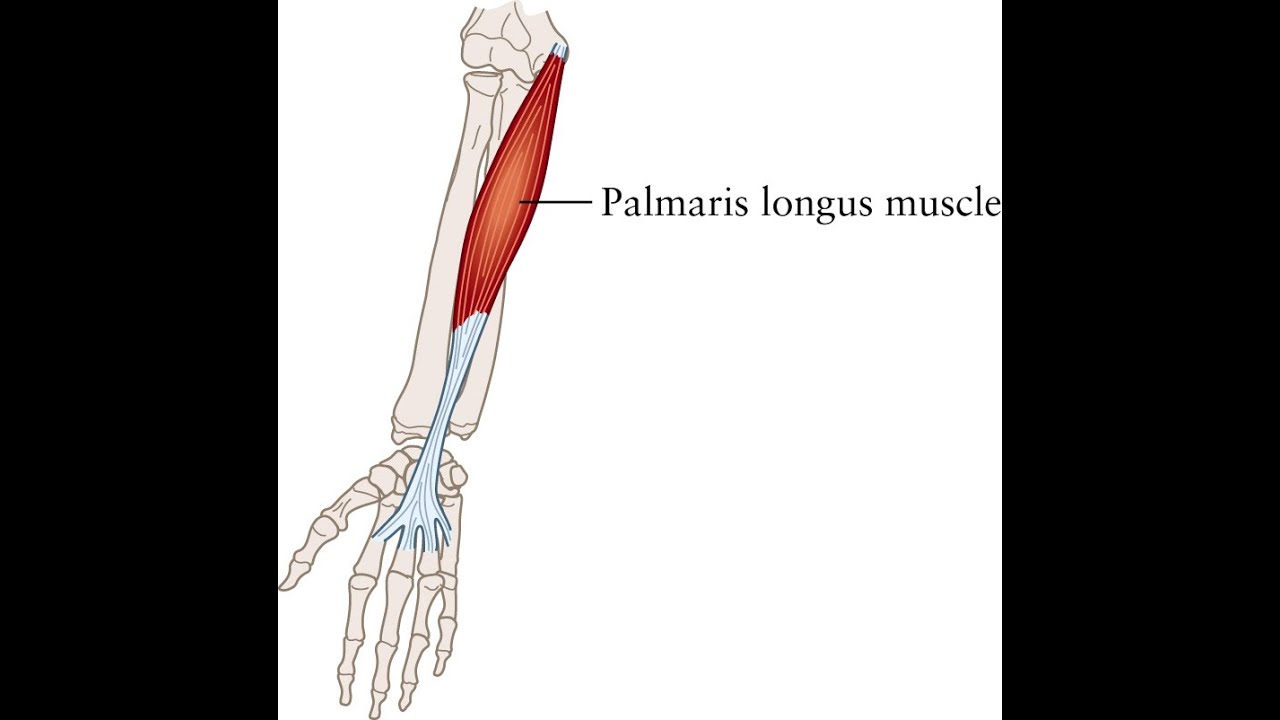 Anatomy of the palmaris longus muscle and Palmar aponeurosis - YouTube