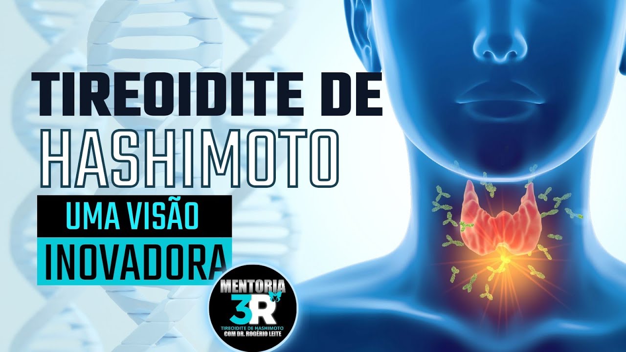 Tireoidite de Hashimoto: UMA VISÃO INOVADORA - YouTube