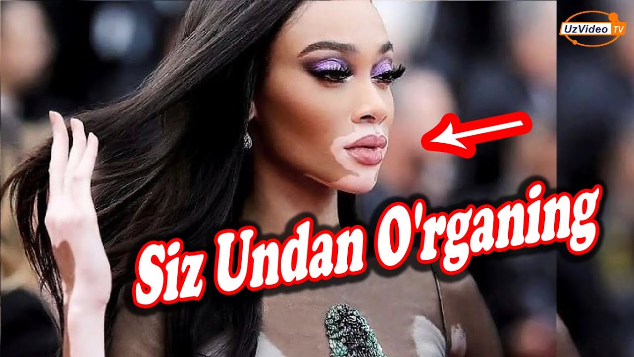 Tashqi ko‘rinishidagi kamchiliklaridan uyalmaydigan modellar ...