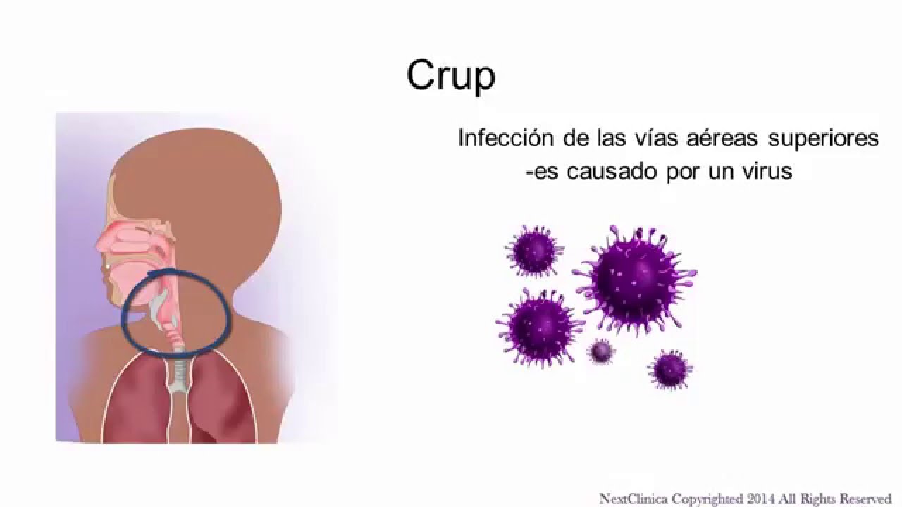 Croup Spanish - YouTube