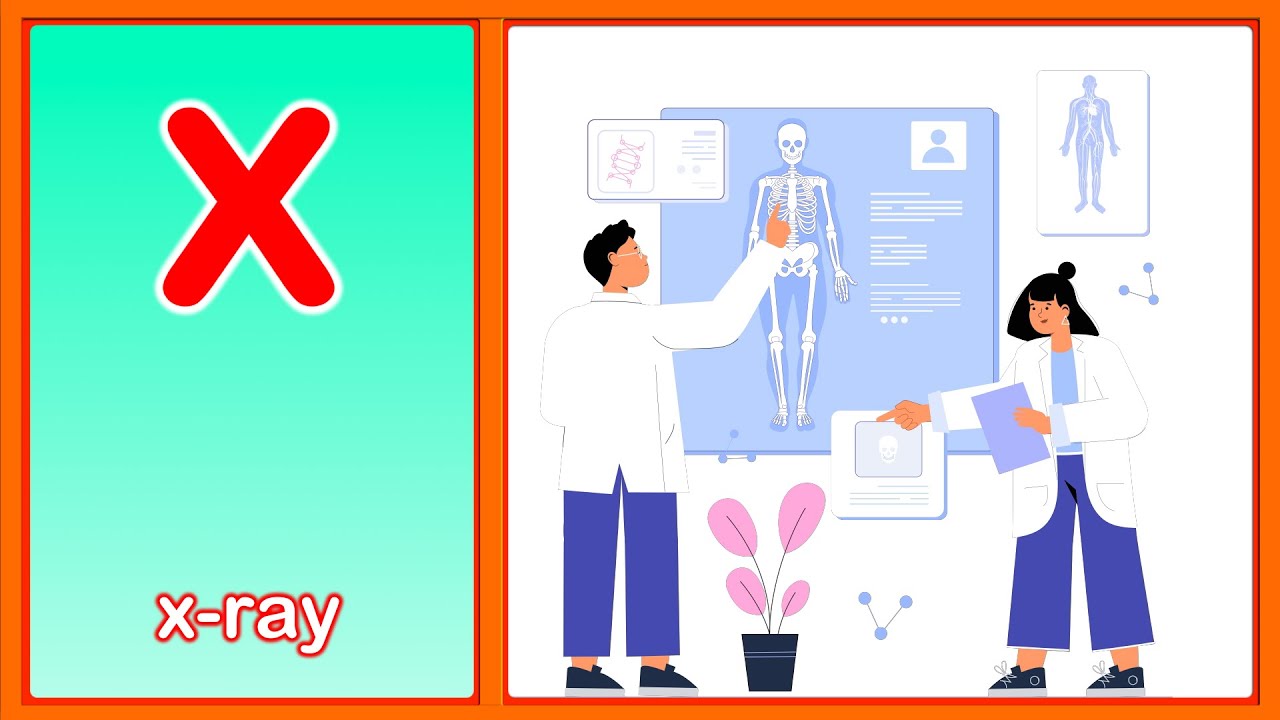 the x Song | Super Phonics | lowercase letter x - YouTube