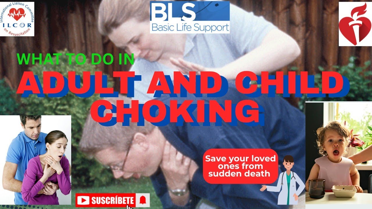 11. Choking in Adults and Children, Basic Life Support. #bls # ...