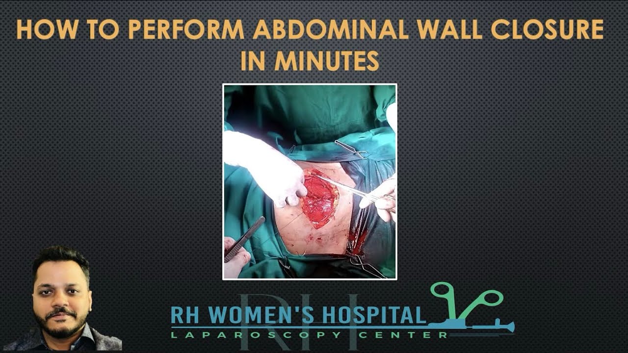 #101:How to perform Abdominal Wall Closure in minutes - YouTube