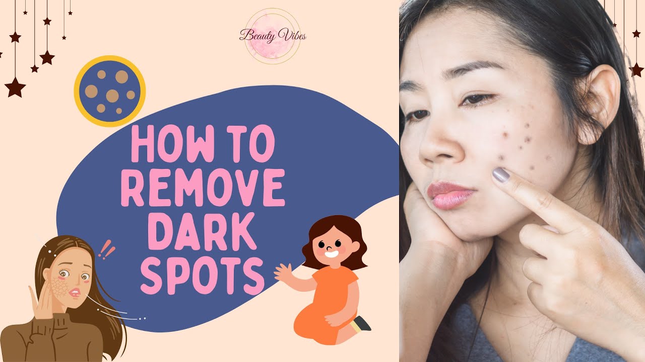 How to Remove Dark Spots | Get Rid of Dark/ Black Spots | Skincare Tips ...