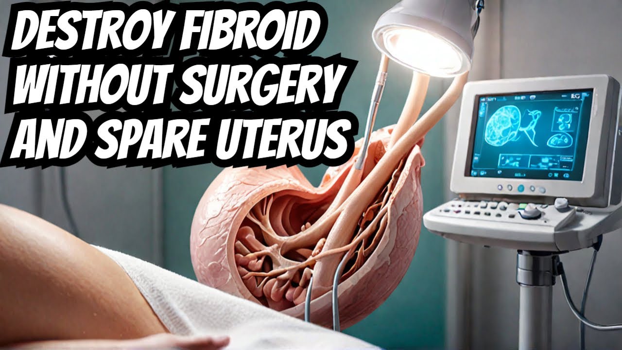 Non Surgical Fibroid Treatment Options Preserve Your Uterus and Enhance ...