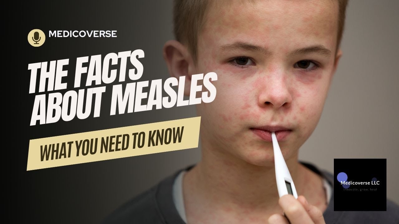 The Facts About Measles: What You Need to Know - YouTube