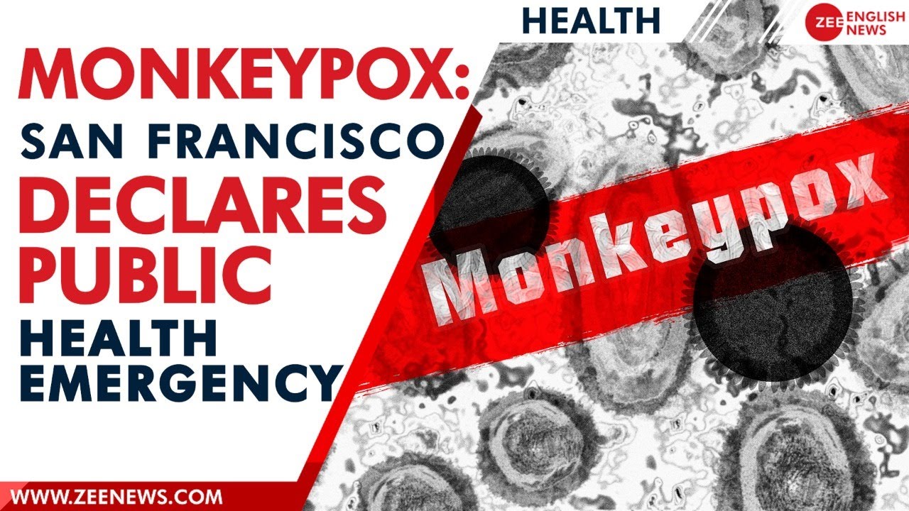 Monkeypox: Amid surging cases, San Francisco declares public health ...